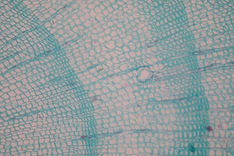 Cross-section Dicot, Monocot and Root of Plant Stem Under the ...