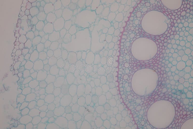 Cross-section Dicot, Monocot and Root of Plant Stem Under the ...