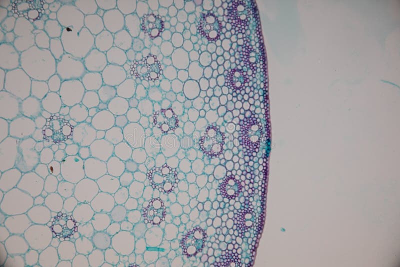 Cross-section Dicot, Monocot and Root of Plant Stem Under the ...