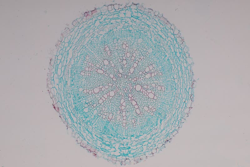 Cross-section Dicot, Monocot and Root of Plant Stem Under the ...