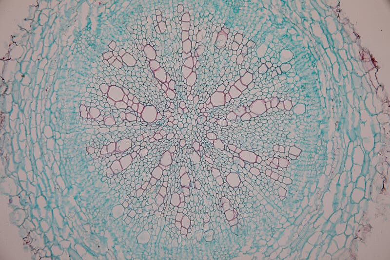 Cross-section Dicot, Monocot And Root Of Plant Stem Under The ...