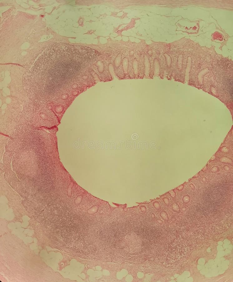 Cross Section through a Human Appendix Stock Photo - Image of circle ...