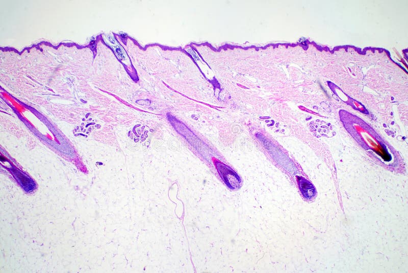 Human Skin Under Microscope Labeled