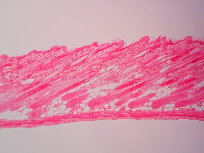 Cross Section Human Skin Tissue Stock Image - Image of follicle ...