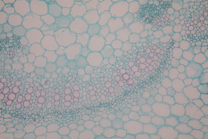 Cross-section Leaf Plant of Under the Microscope. Stock Image - Image ...