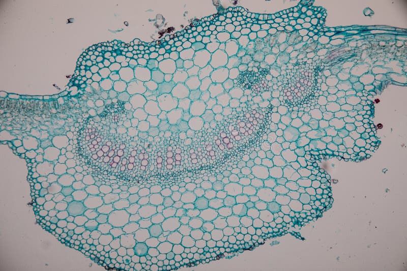 Cross-section Leaf Plant of Under the Microscope. Stock Photo - Image ...