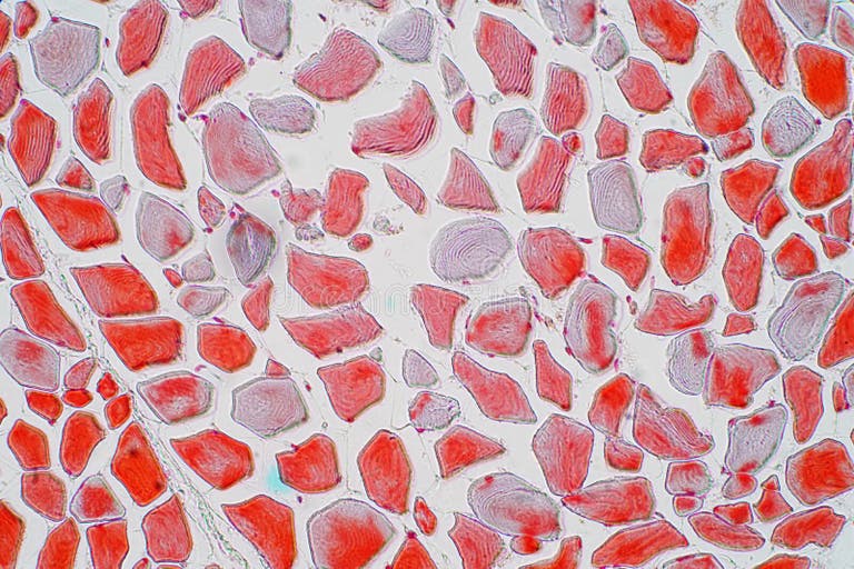 Tendon Cross Section Stock Photos - Free & Royalty-Free Stock Photos ...