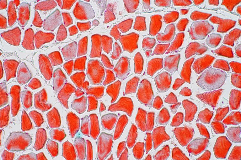 Tendon Cross Section Stock Photos - Free & Royalty-Free Stock Photos ...