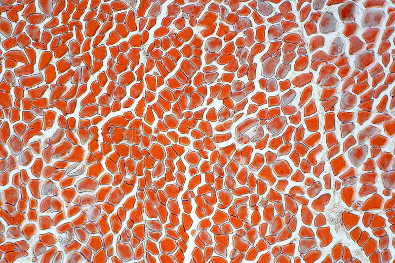Cross Section Muscle Skeleton Micro Preparation Samples- Section Tissue ...