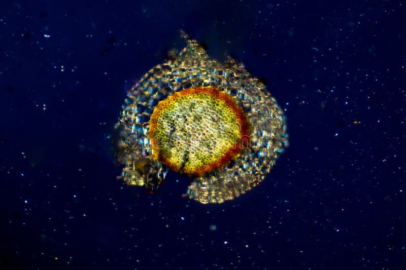 Cross Section of a Peat Moss Stem, with Polarization Stock Photo ...