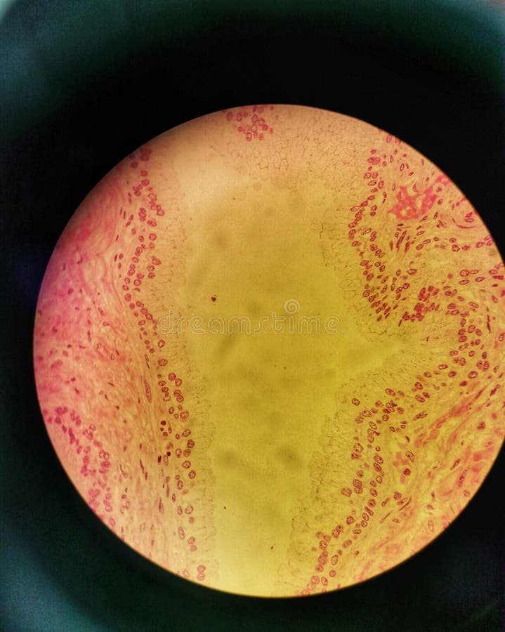 Cross-Section through a Prostate Gland Stock Photo - Image of body ...