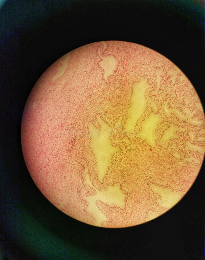 Cross-Section through a Prostate Gland Stock Photo - Image of internal ...