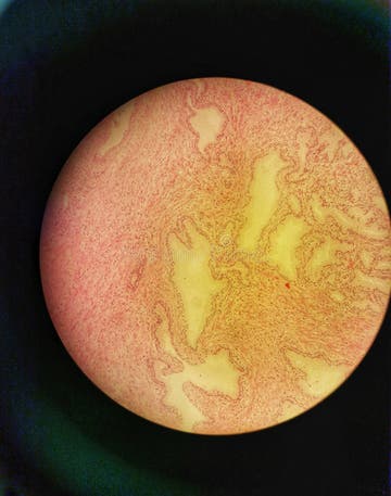 Human Urinary Bladder Under Microscope Labeled Stock Photos - Free ...