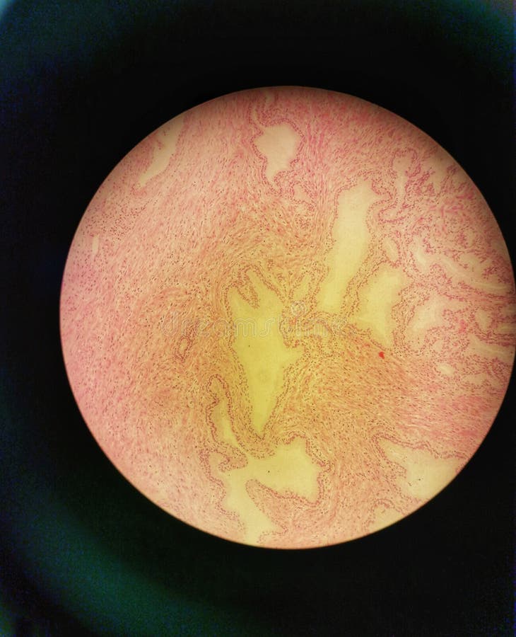 Cross-Section through a Prostate Gland Stock Photo - Image of males ...