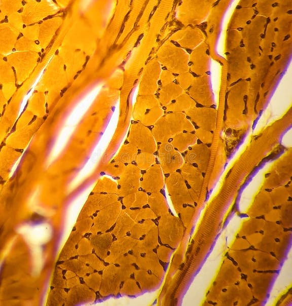 Cross-Section of a Skeletal Muscle Tissue Stock Photo - Image of ...