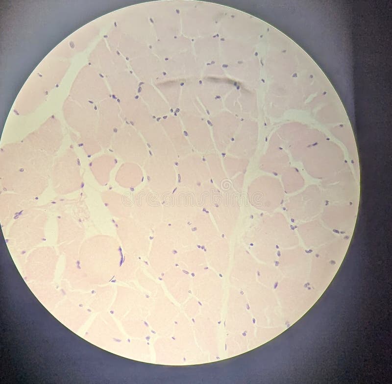Cross-Section of a Skeletal Muscle Tissue Stock Image - Image of body ...