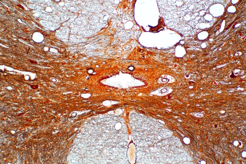 Spinal Cord Cross Section Microscope