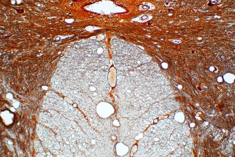 Cross Section of Spinal Cord Under the Microscope View. Stock Photo ...