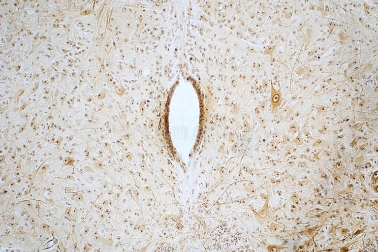 Cross Section of Spinal Cord Under the Microscope View Stock Photo ...