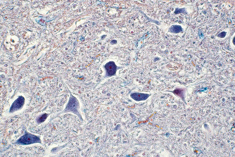 Cross Section of Spinal Cord Under the Microscope View Stock Image ...
