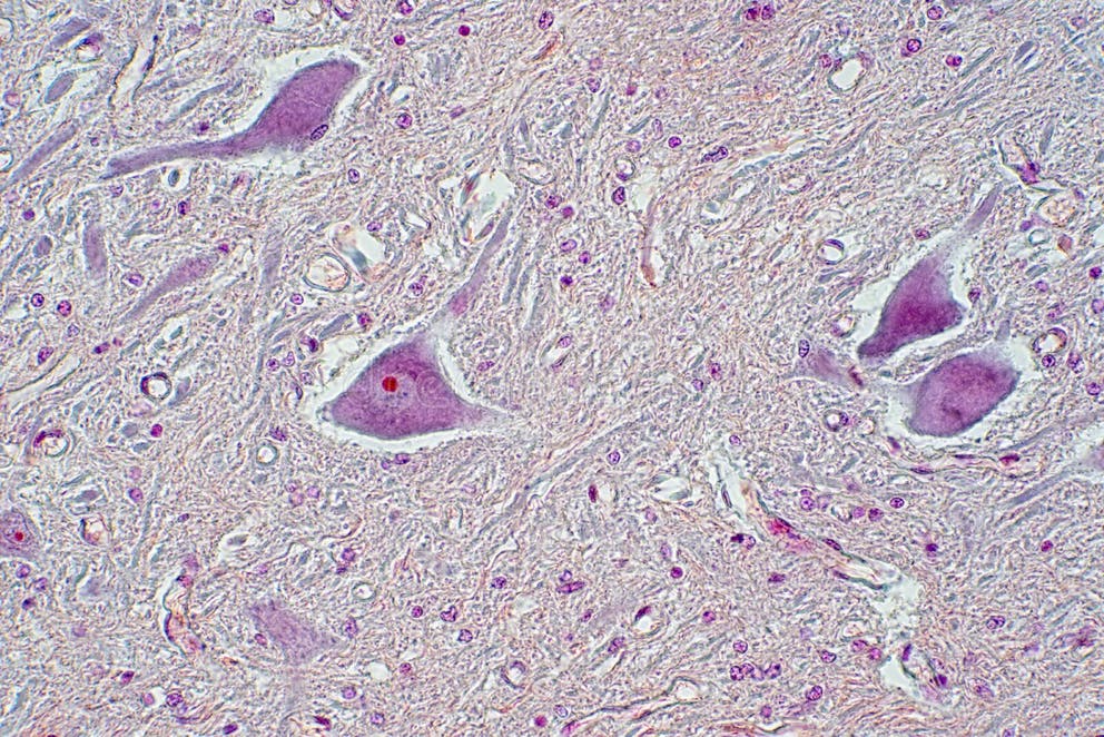 Cross Section of Spinal Cord Under the Microscope View Stock Photo ...