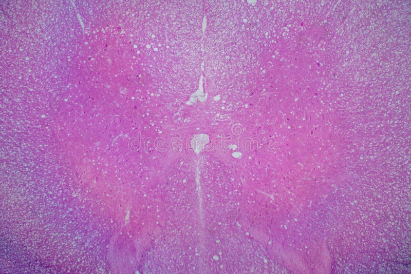 Cross Section of Spinal Cord Under the Microscope View Stock Photo ...