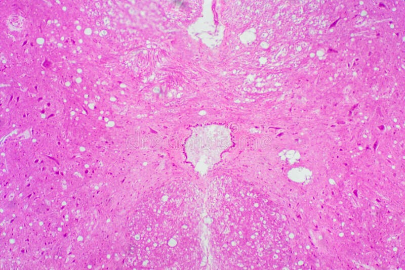 Cross Section of Spinal Cord Under the Microscope View Stock Image ...
