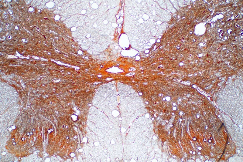 Spinal Cord Cross Section Under the Microscope Showing Neurones and ...