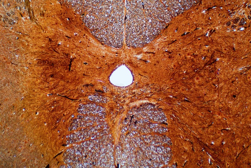 Cross Section of Spinal Cord Under the Microscope View Stock Image ...