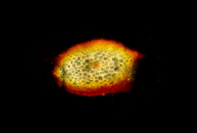 Cross Section of the Stem of a Moss, with Polarization Stock Image ...