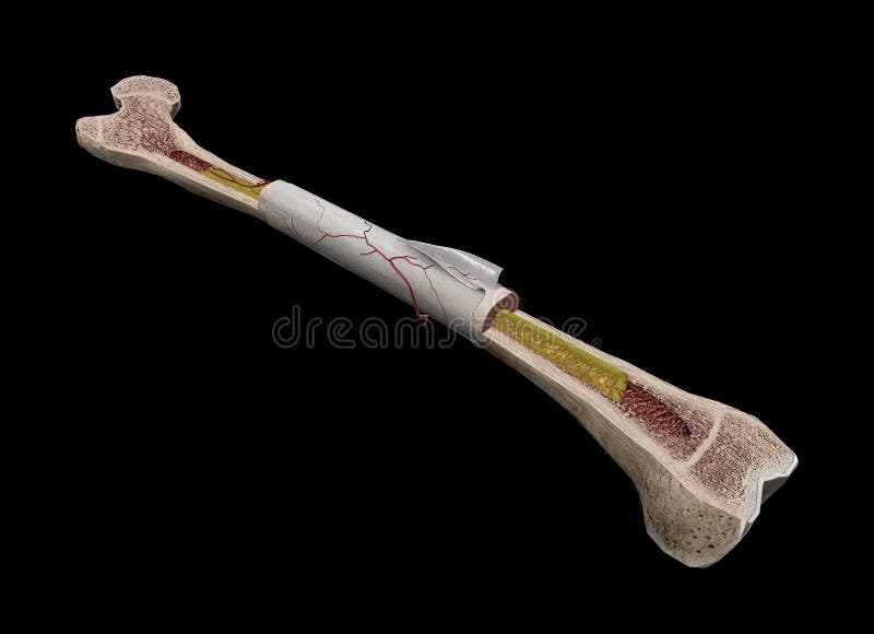 A Femoral Neck Fracture is a Type of Hip Fracture that Occurs in the ...