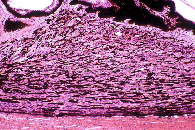 Human eye. Ciliary body stock photo. Image of ocular - 303600480