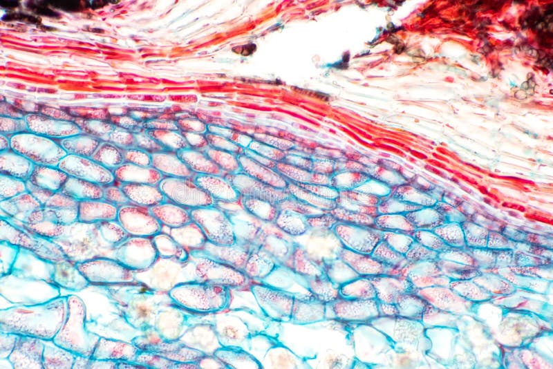 Histological Structure of Pine Stem Vascular Bundle Under Microscope ...