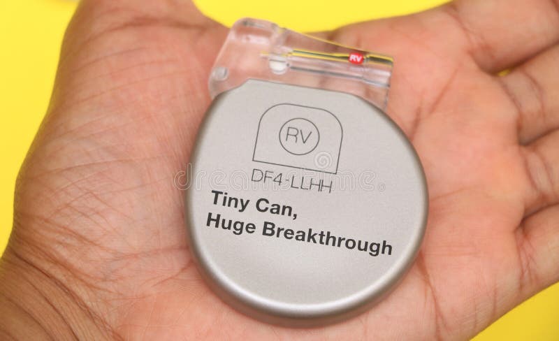 Cardiac Re-synchronization Therapy Device with Pacemaker (CRT-P) Placed ...