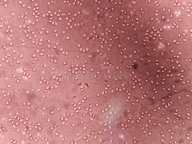 Cryptococcus Neoformans - Cerebrospinal Fluid Stock Photo - Image of ...