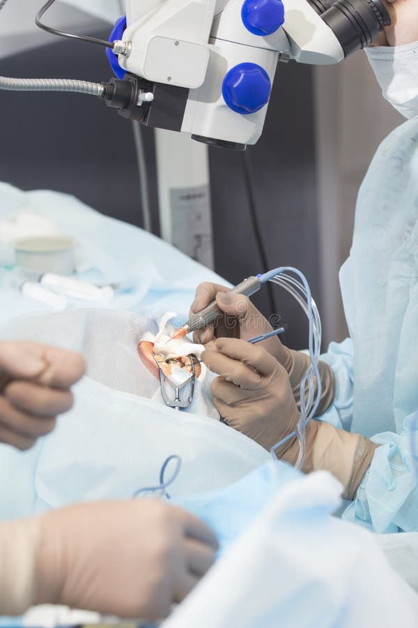 Crystalline Lens Replaceable Surgical Method Stock Photo - Image of ...