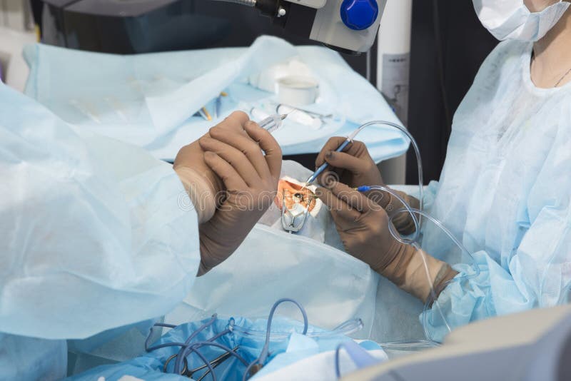 Crystalline Lens Replaceable Surgical Method Stock Photo - Image of ...