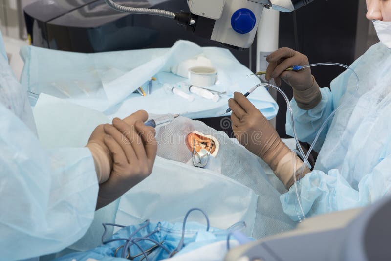 Crystalline Lens Replaceable Surgical Method Stock Image - Image of ...