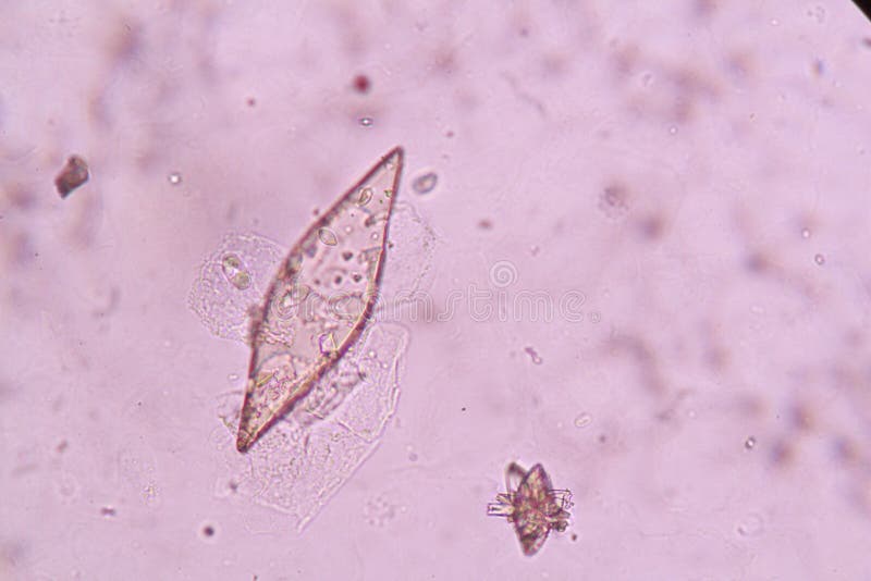 138 Urine Crystals Stock Photos - Free & Royalty-Free Stock Photos from ...