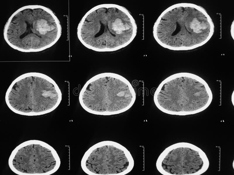 CT-Brain stock image. Image of cross, font, head, background - 106140627