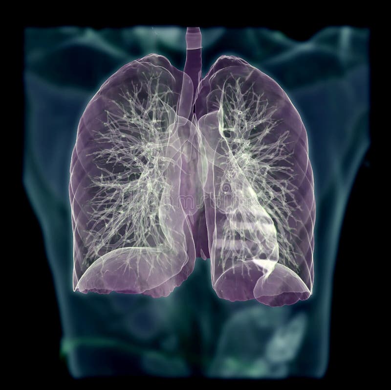 CT Chest or Lung 3D Rendering Image with 3D Heart Image. Stock ...