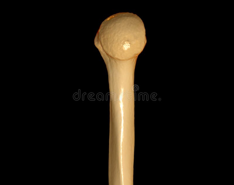 CT head of humerus 3D stock illustration. Illustration of diagnosis ... CT head of humerus 3D stock illustration. Illustration of diagnosis ...
