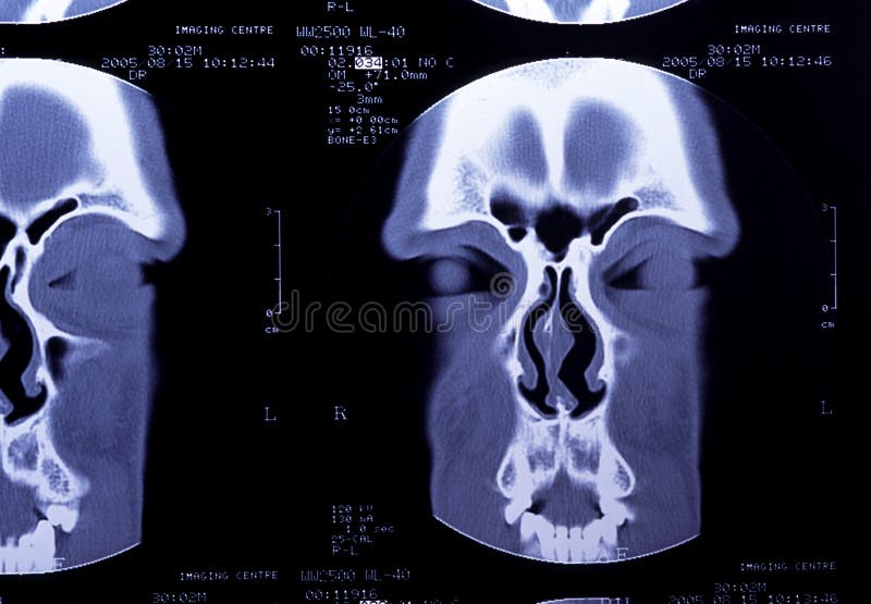 CT Head Scan Detail stock photo. Image of computer, brain - 782580