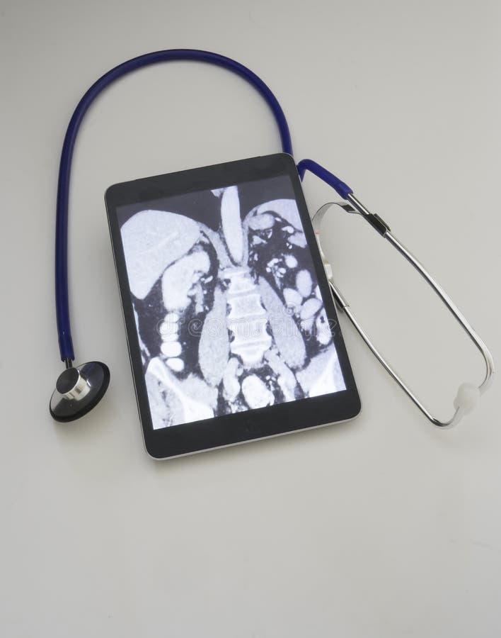 Ct Scan To Perform and Evaluate a Patient Status and Create a Diagnosis ...