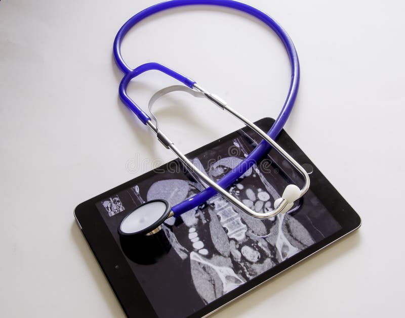 Ct Scan To Perform and Evaluate a Patient Status and Create a Diagnosis ...