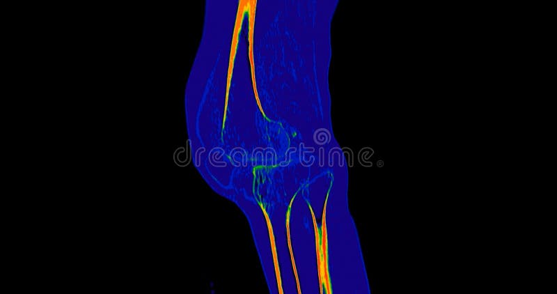 Human Knee Bone Joint Icon Stock Photos - Free & Royalty-Free Stock ...