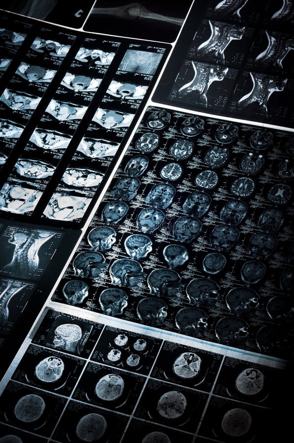 CT and MRI scan images stock image. Image of emission - 18853413