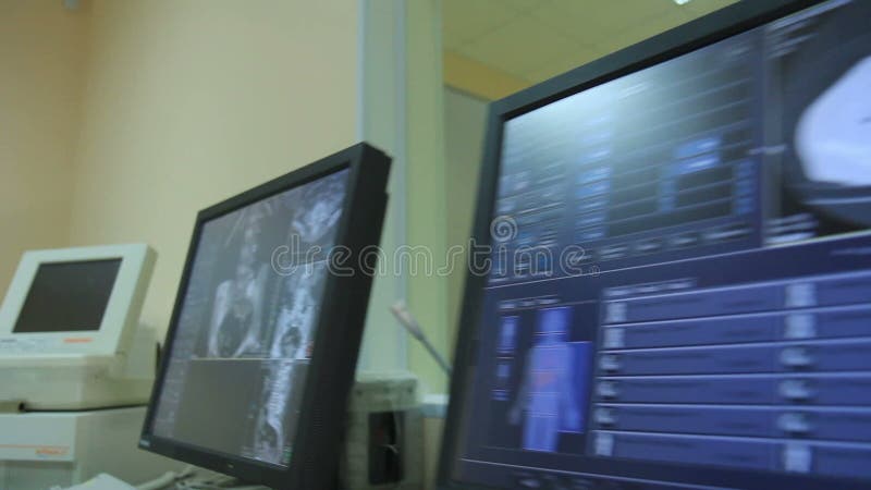 CT and MRI Scanning Room (on Dolly) Stock Video - Video of computer ...