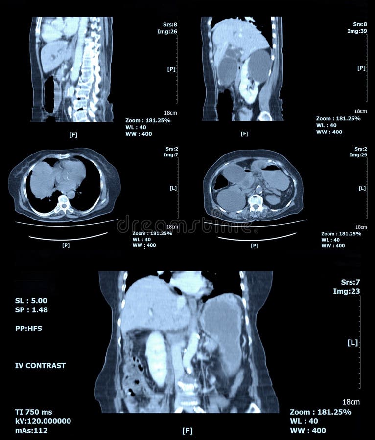 Ct scan abdomen and body stock photo. Image of care - 300897254