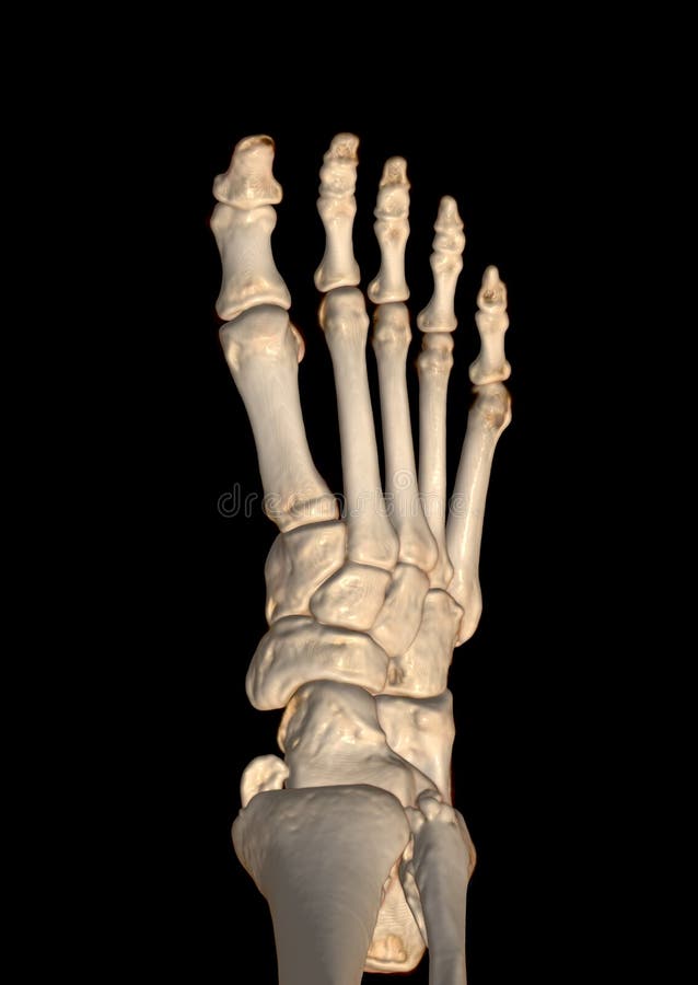 Ct Scan Ankle And Foot Stock Illustration Illustration Of Arthritis 256462422
